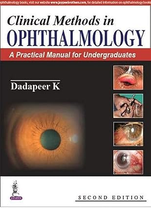 Clinical Methods in Ophthalmology: Practical Manual for Undergraduates ...